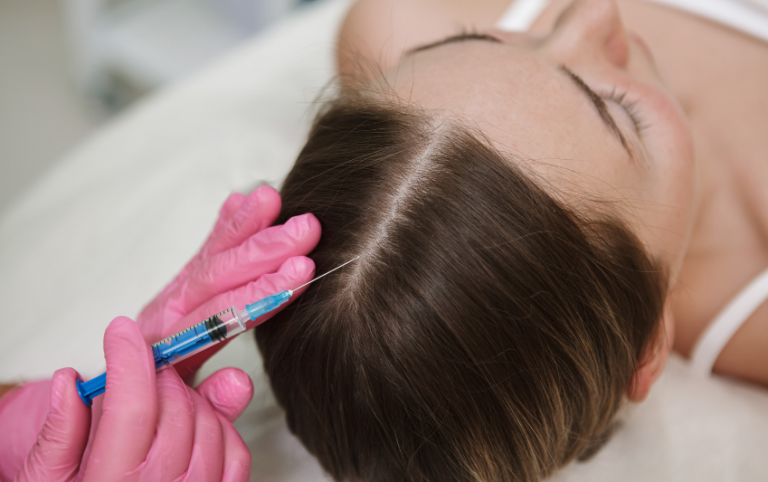 Platelet-Rich Plasma (PRP) Injection Hair Loss Treatment: Does It Work ...